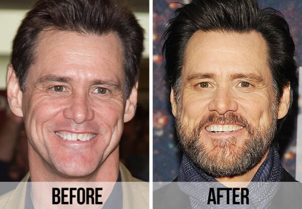 Celebrity Tooth Transformations That Will Make You Smile