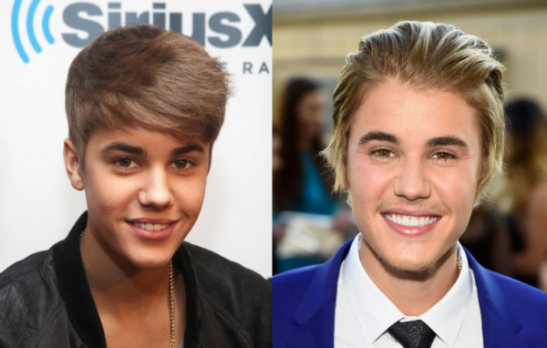 Celebrity Tooth Transformations That Will Make You Smile